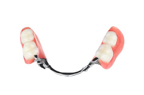 What Is A Mandibular Partial Denture At Daniel Gilmore Blog