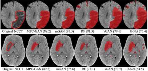 two segmentation examples obtained by all the five compared methods