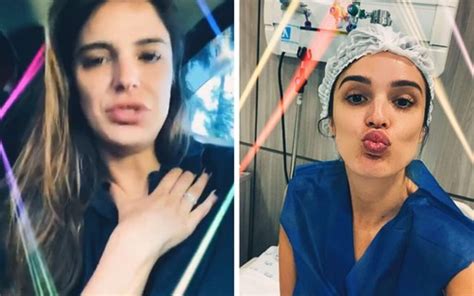 Rafa Brites irá refazer cirurgia da cesariana Dói muito Quem
