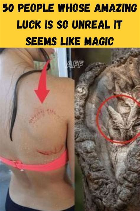 39 People Whose Genetics Made Them Unique Artofit