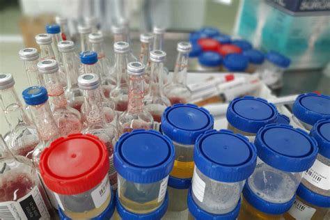 Missing Virus Vials Trigger Biosecurity Probe In Australia