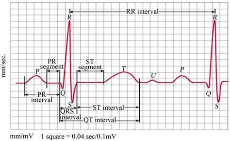 ECG Signal Specification In 3 Download Scientific Diagram