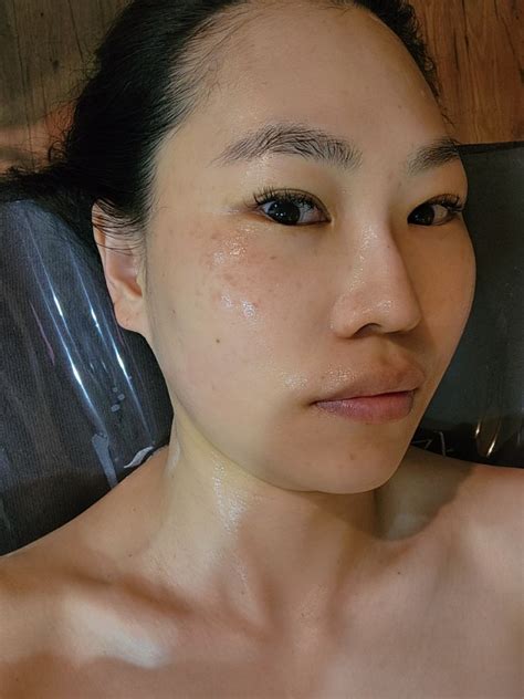 일산피부관리 에스테틱 쉬작에서 비타 트리트먼트로 문제성피부 관리하기 네이버 블로그
