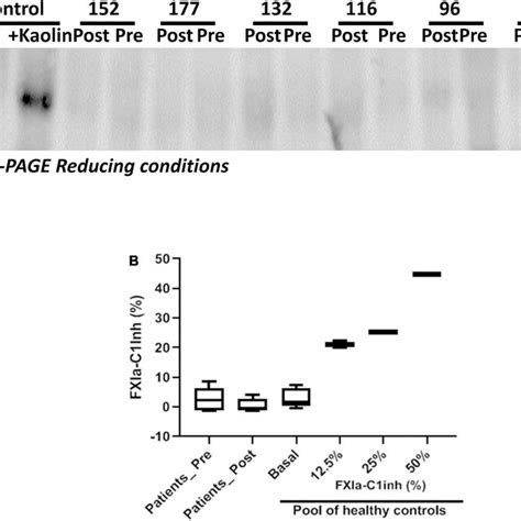 Fxia Levels In Patient Samples Pre And Post Procedure A Download Scientific Diagram