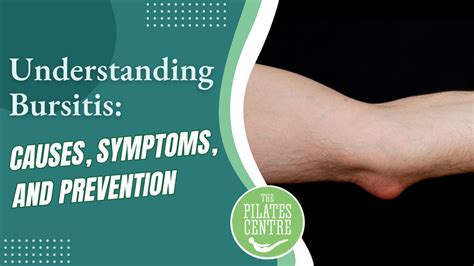 Understanding Bursitis Causes Symptoms And Prevention Pilates Centre
