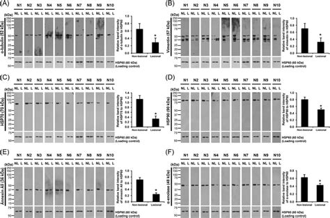 Validation Of The Proteomic Data And Quantitative Analysis By Western