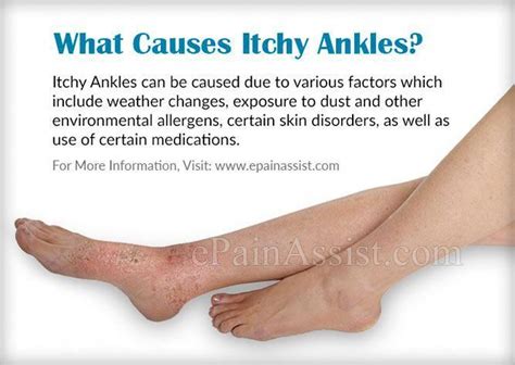 After College Experience Why Are My Ankles Itchy
