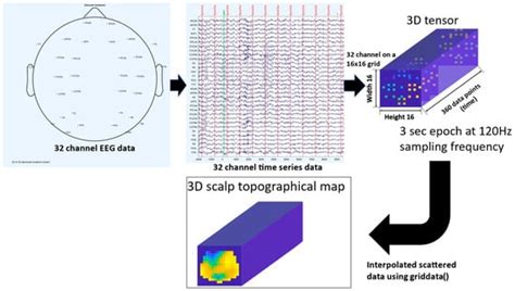 Brain Sciences Special Issue Advances Of Ai In Neuroimaging