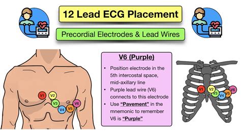 ecg limb leads color coding interpretation