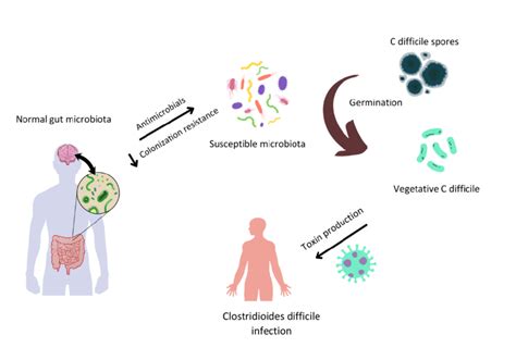 Gut Microbiota And Clostridioides Difficile Infection Cdi Download Scientific Diagram