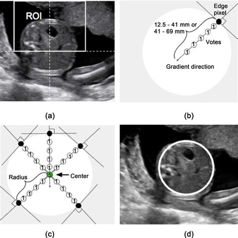 Pdf Automatic Measurement Of Fetal Abdominal Biometric Parameters—feasibility On A Portable