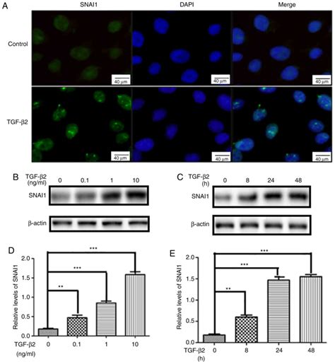 Snai1 Interacts With Hdac1 To Control Tgf‑β2‑induced Epithelial