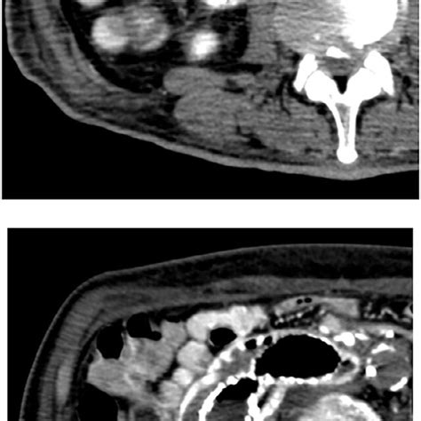 A Computed Tomography Ct During Aortography Of The Thoracic Download Scientific Diagram