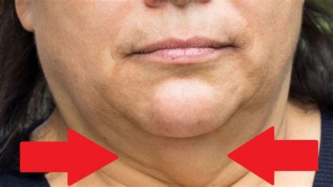 5 Exercises To Eliminate Double Chin And Tone The Neck At Home In A