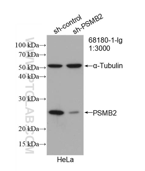 Psmb Antibody Ig Proteintech