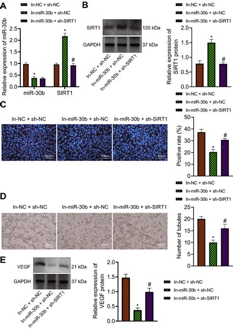 inhibition of mir 30b alleviates hg induced angiogenesis through