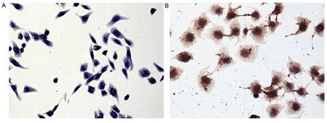 Immunocytochemical Staining Of Cultured GIST T Cells A Download Scientific Diagram