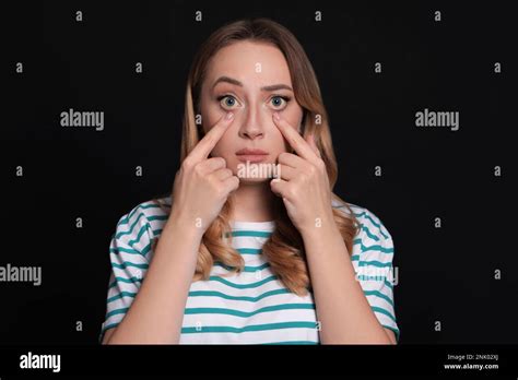 Woman With Yellow Eyes On Black Background Liver Problems Symptom