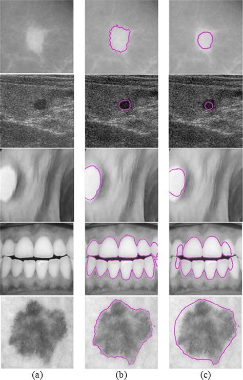 segmentation results of the empirically fine tuned version and the