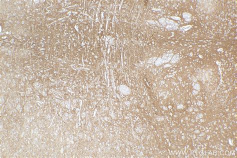 Cd200 Antibody 83437 5 Pbs Proteintech