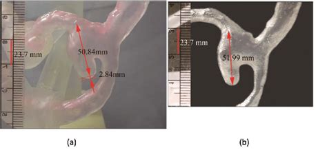 phantom of the 3 25 fold patient specific model a elastic model b
