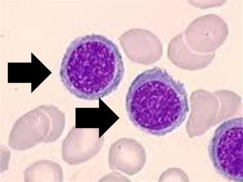 Lineage Specific Hematopoiesis Flashcards Quizlet