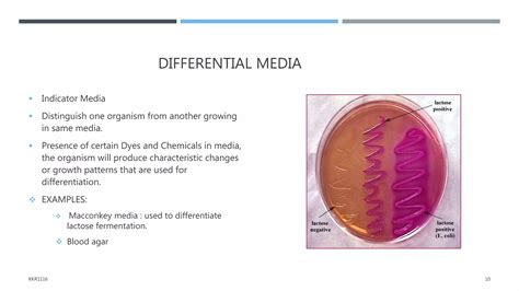 Bacterial Culture Media Ppt