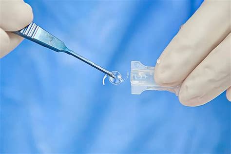 Implants Phakes Ou Lentilles Artificielles Dr Rambaud à Paris