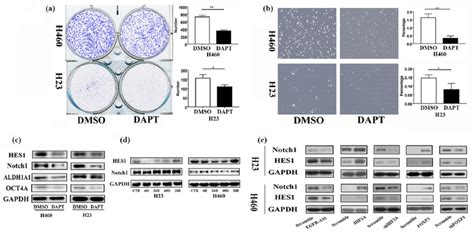 The Critical Role Of The Notch Pathway In Foxp3 Mediated Nsclc Cell