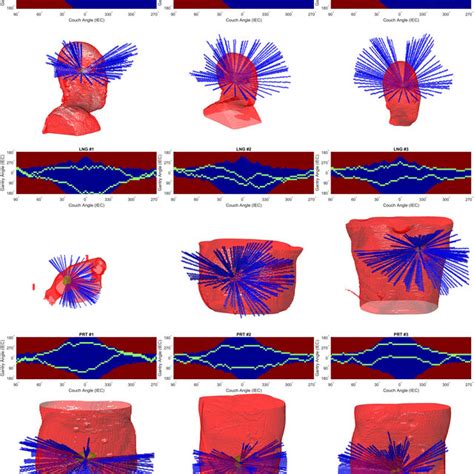 The Selected Beam Angles On The Gantrycouch Graph With Corresponding Download Scientific