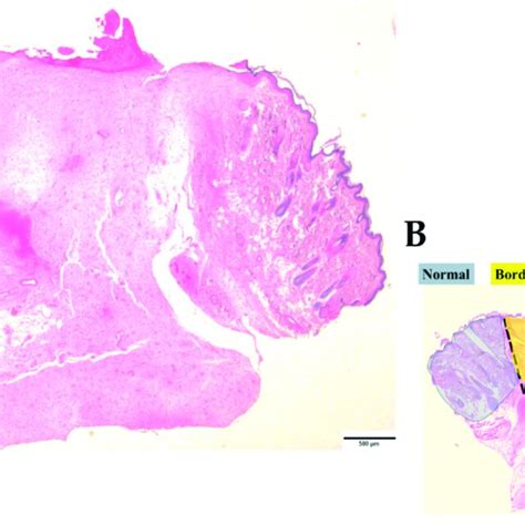 Schematic Image Of A Skin Sample Stained With Hematoxylin And Eosin