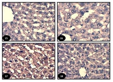 Photomicrograph Of Normal Liver Section From Control Rat Showing The
