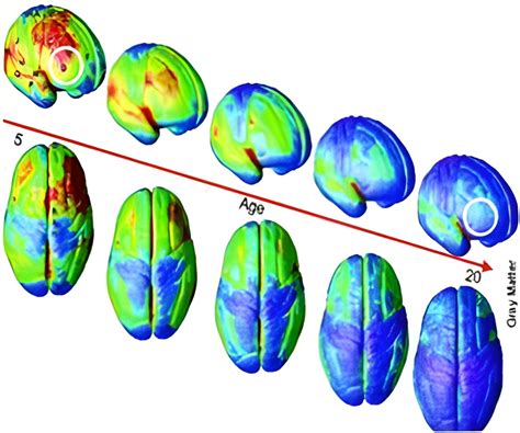 Neurons Tuning To Different Frequencies In The Brain For Different