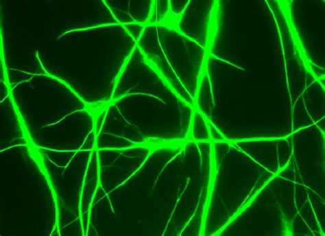 Microscope Image Of Human Astr [image] Eurekalert Science News Releases