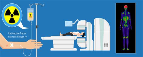 What Is A Petct Scan Oklahoma How Do Petct Scans Work