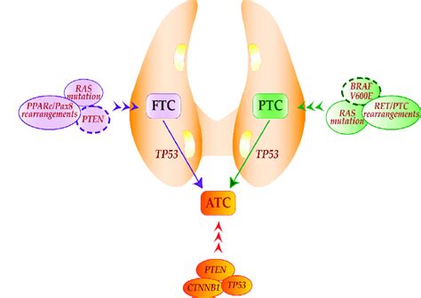 Schematic Representation Of Thyroid Cancer Hystotypes And Their
