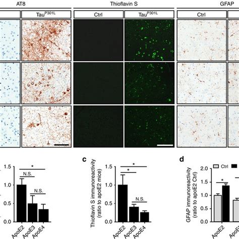 Increased Hyperphosphorylated Tau Species Thioflavin S Positive Tau
