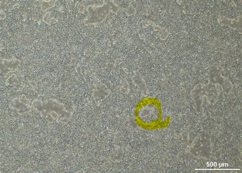 What Kind Of Apoptosis Do You Think Researchgate