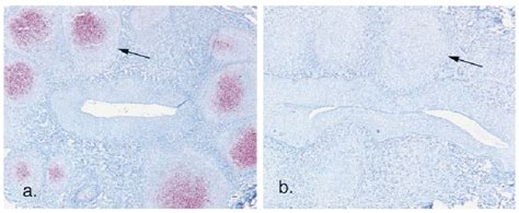 Tonsillar Biopsy Collected From Cwd Positive A And Negative B Download Scientific Diagram