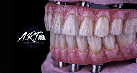 Jack Marrano Miyo World