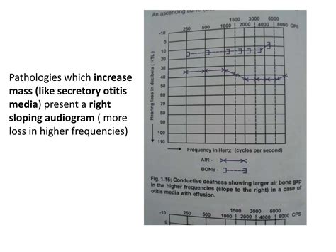 Audiological Tests Of Hearing Assessment Pptx