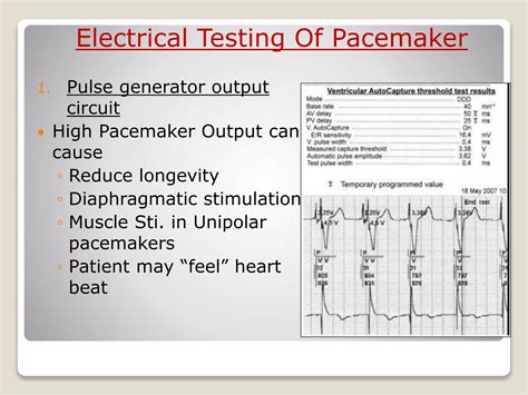 Follow Up And Management Of Pacemaker Programming And Pptx