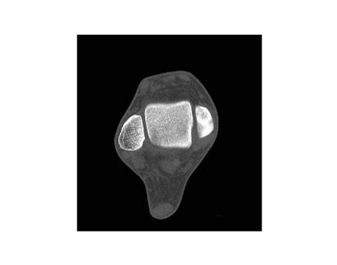 Ankle Axial — Printable Worksheet
