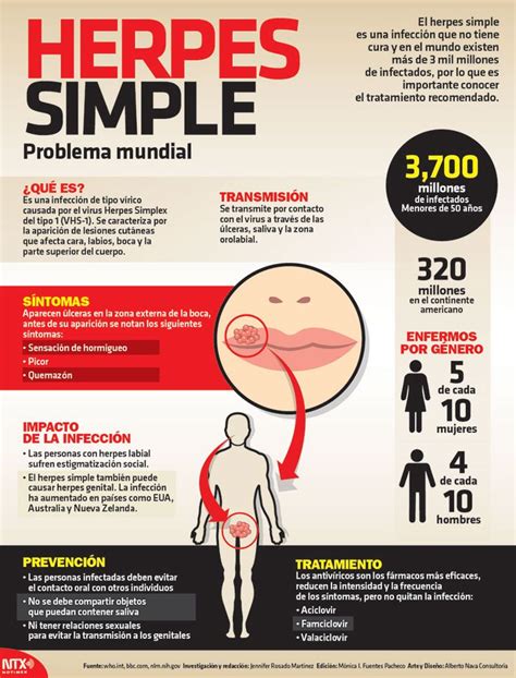 Undato Existen 3700 Millones De Infectados De Herpes Simple Conoce
