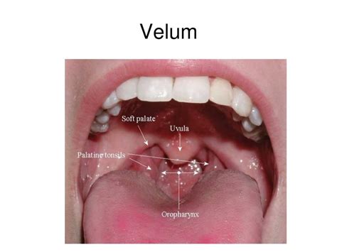 Function Of Velum In Medusa At Manuel Bridges Blog