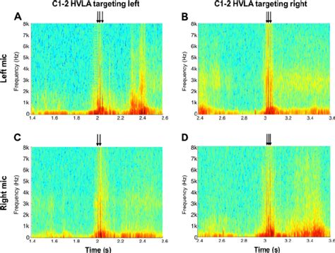 Four Spectrograms From A Single Subject Corresponding To The Audio