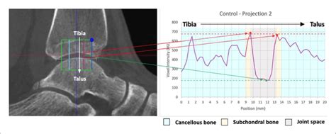 Graphic Showing An Example Of An Intensity Projection Through The