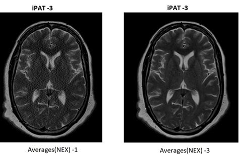 What Is Parallel Imaging At Cooper Meares Blog
