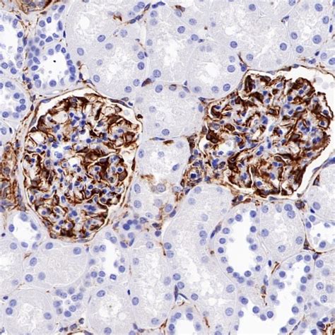 Anti Rabbit Hrp Dab Ihc Detection Kit 斯达特公司官网