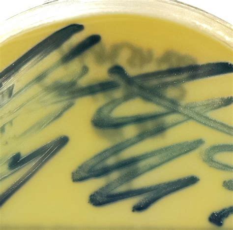 Med Lab Facts 1st Column Refmethod 2nd Column Analyte Gold